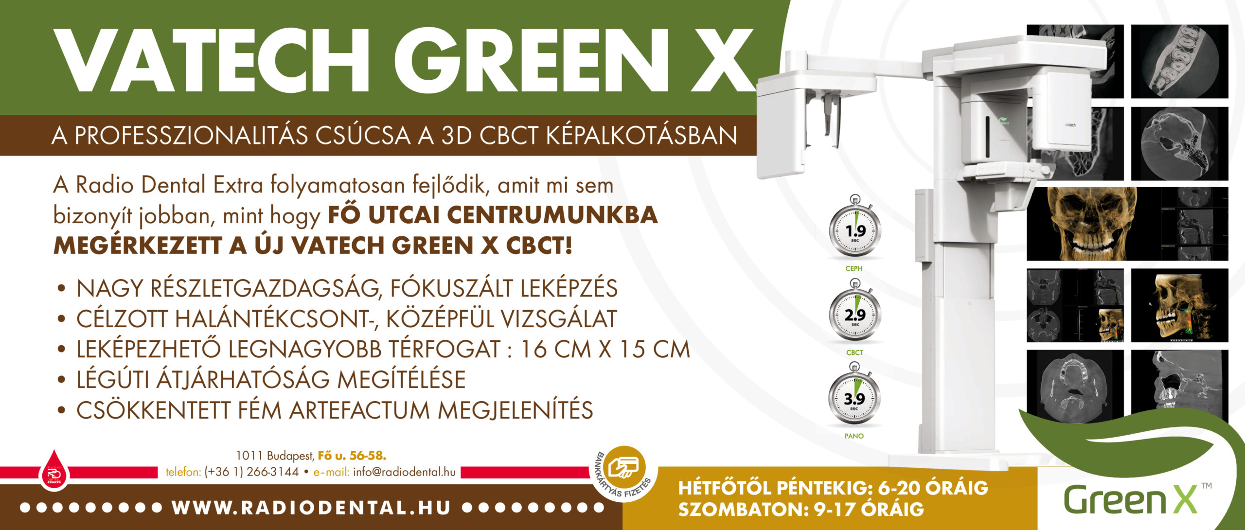 Vatech Green X - a professzionalitás csúcsa a 3D CBCT képalkotásban