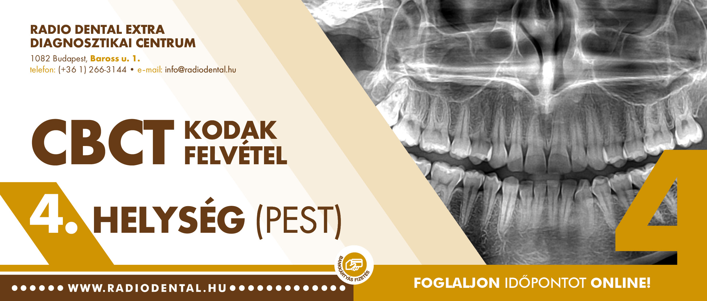 Röntgen - KODAK CBCT Felvétel - 4. helyiség (Pest) - Radio Dental
